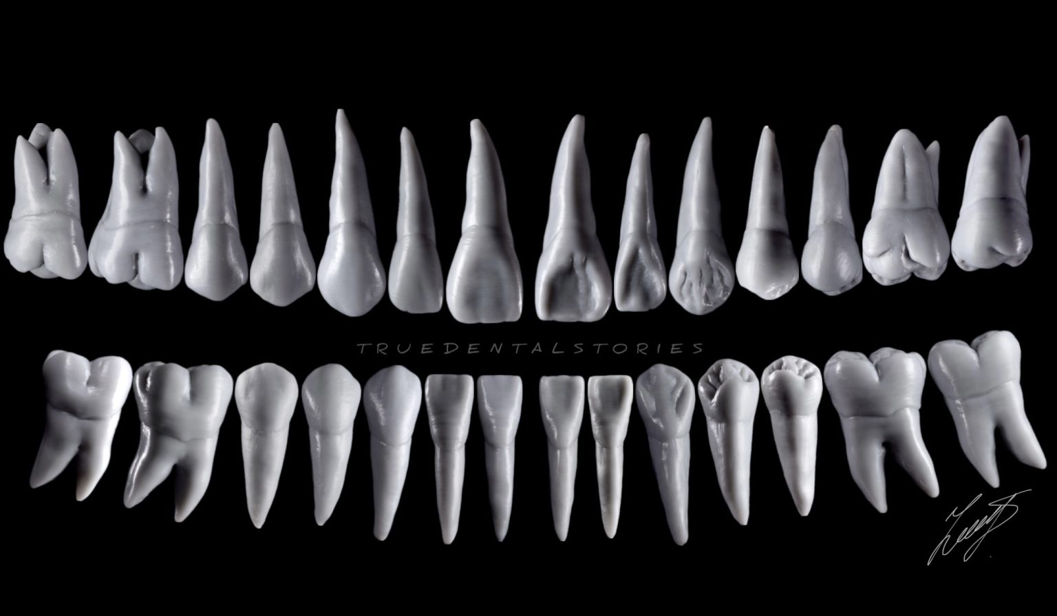 Types of Dental Prosthesis: A Complete Guide for Patients in Luxembourg